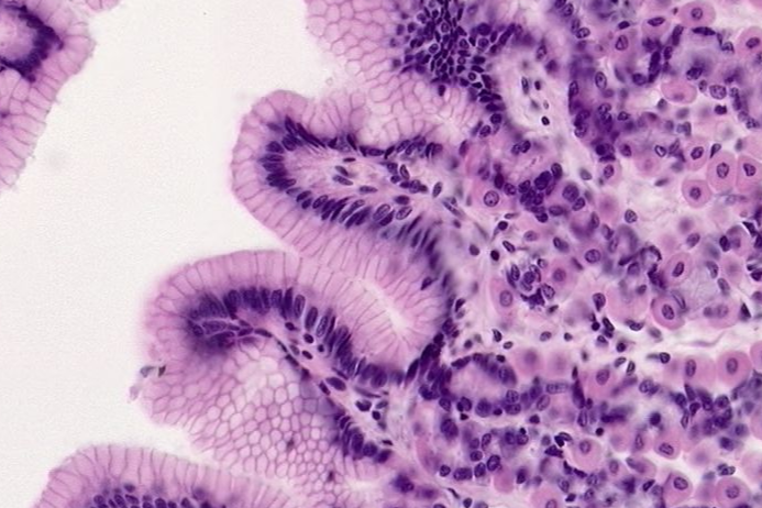 Simple Columnar Epithelium Stomach